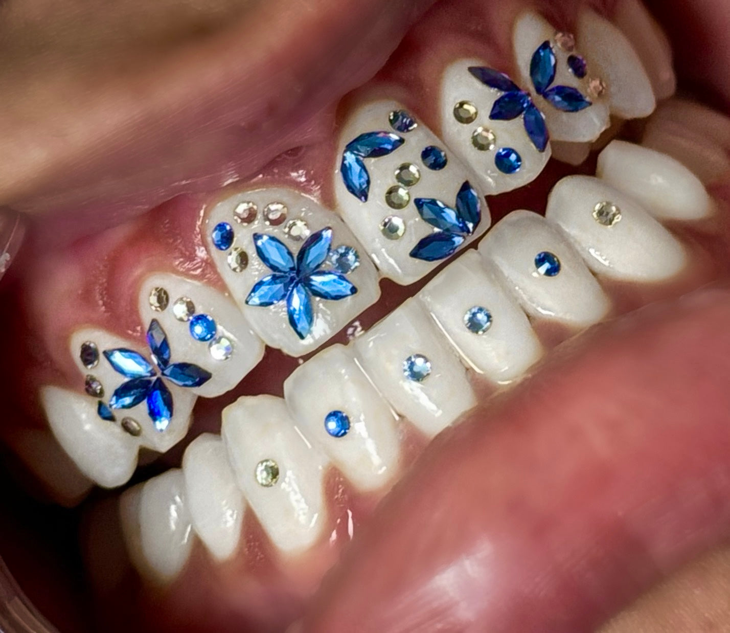 The Tooth Fairy Melbourne 💫 – The Tooth Fairy melb